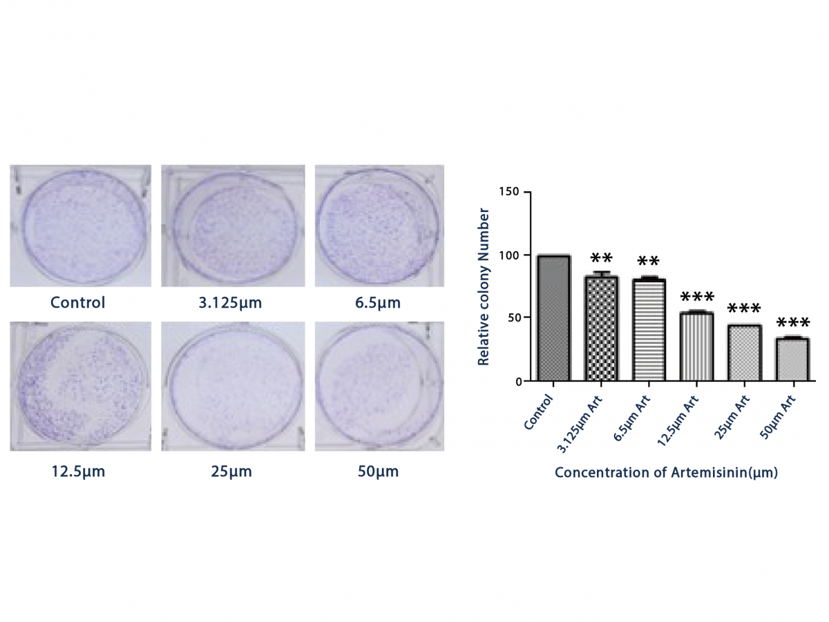 Artemisinin and Its Derivatives in the Treatment of Eye Cancer ...