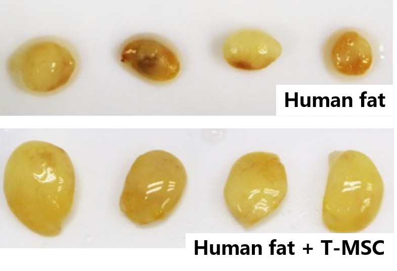 New breakthrough of FHS in stem cell research promotes fat engraftment ...