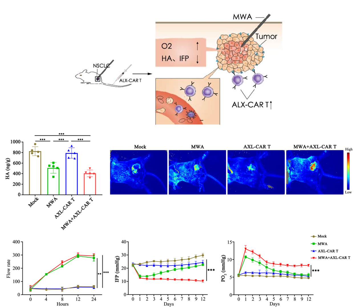 UM and Guangzhou Medical University (GMU)'s new breakthrough in CART ...
