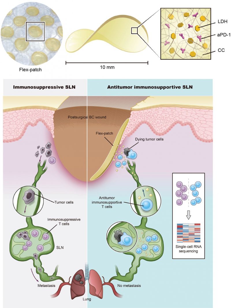 UM research team reports an immuno-adjuvant flex-patch to protect post ...